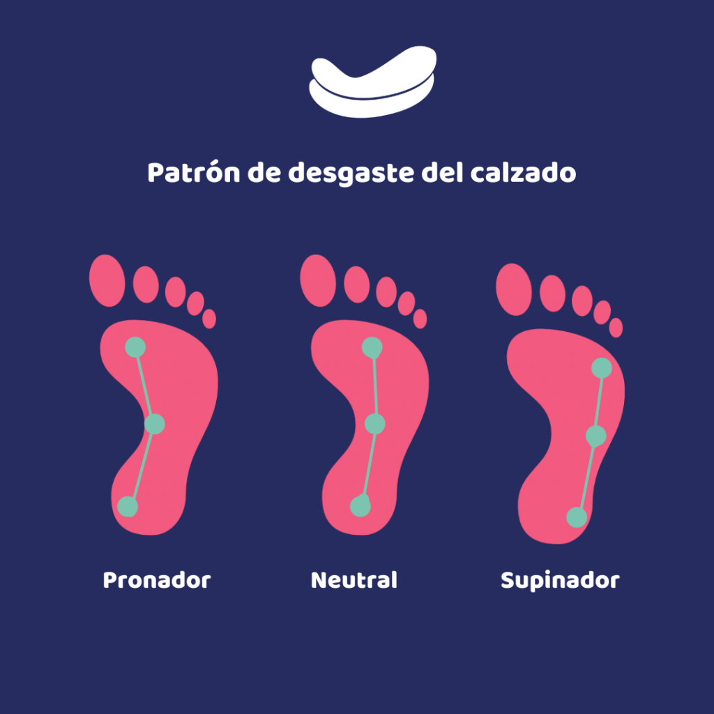 Existen tipos de Pisada? - PROFEET - Plantillas Ortopedicas