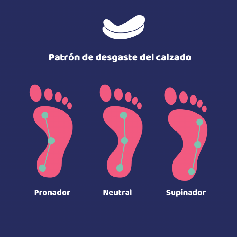 Existen tipos de Pisada? - PROFEET - Plantillas Ortopedicas